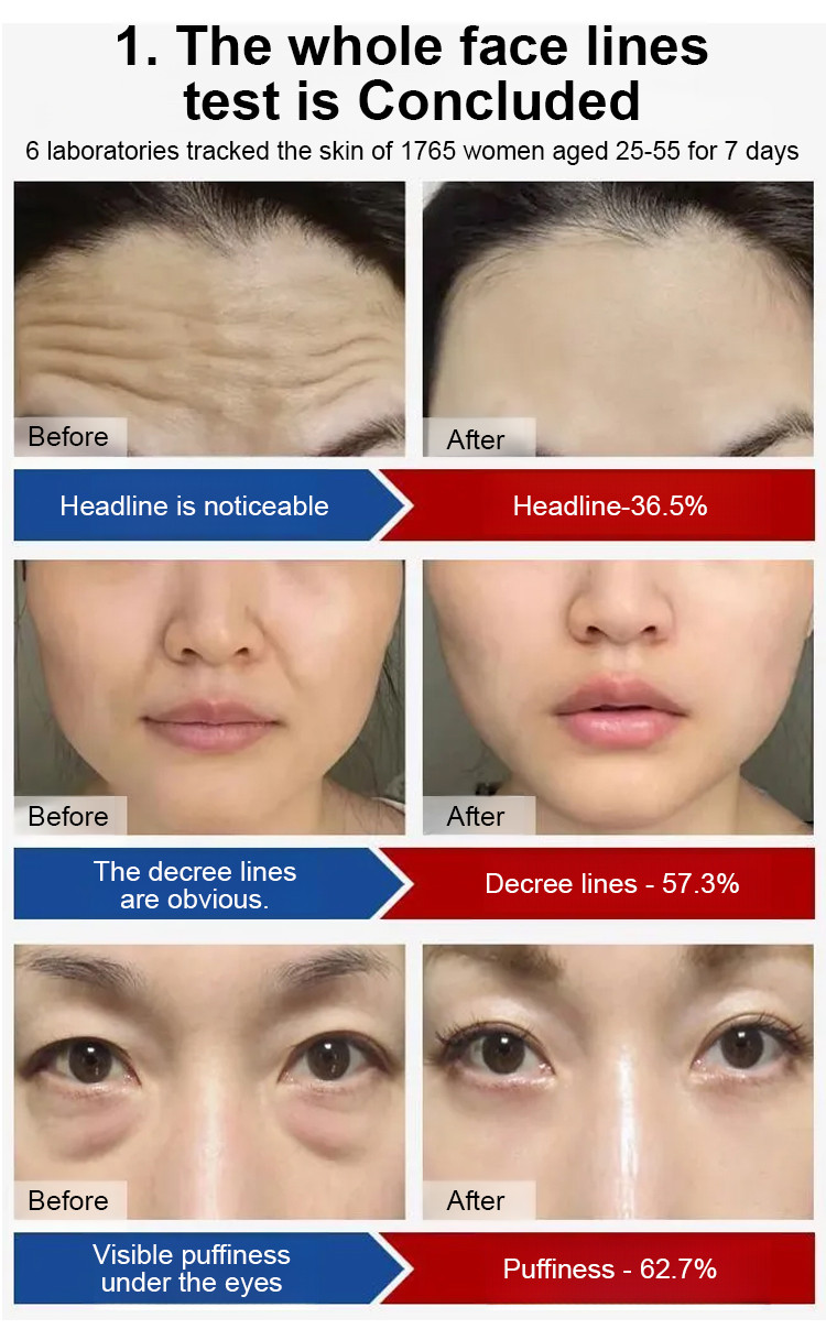 Moisturizing Cream Ingredient Synersis Non-sticky and Non-stuffy ...