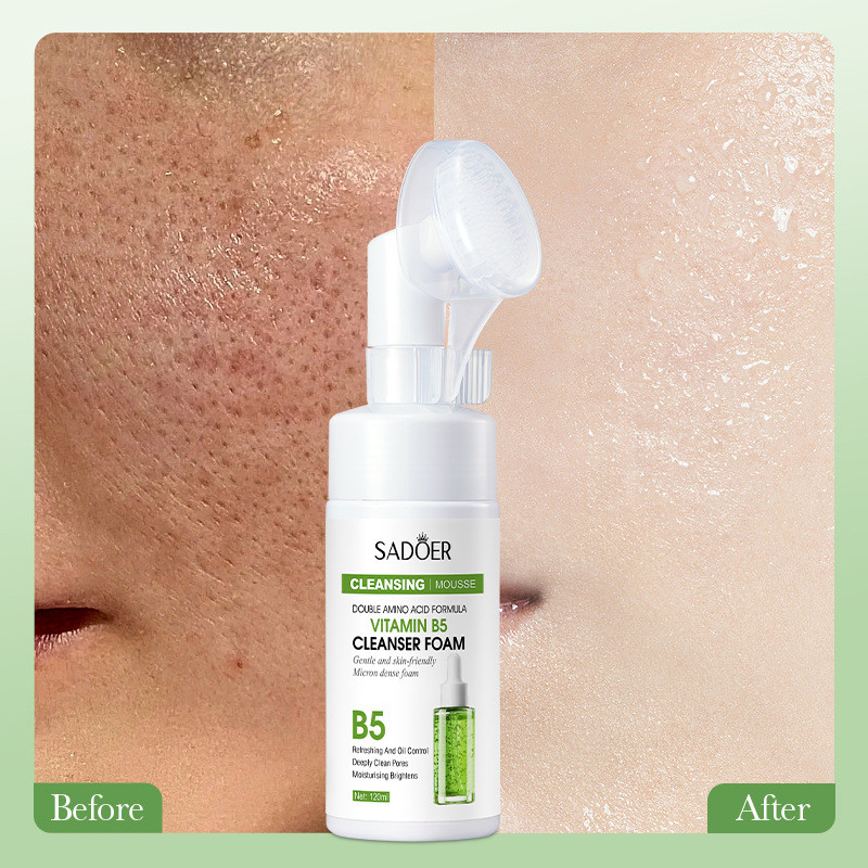 Sadoer Vitamin Nourishing B5 Amino Acid Foaming Cleanser Mild 120ml Face Wash | Shopee Malaysia