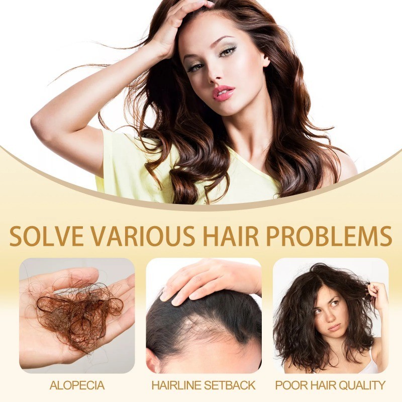 Ginger Hair Growth Shampoo Hairs Regrowth Thickening Scalp Treatment ...