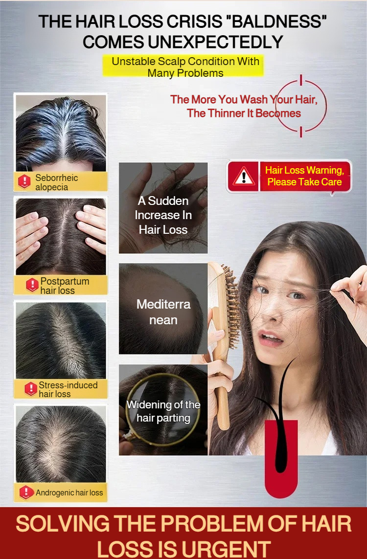 Spot/Send In Seconds Handmade Hair Growth Soap Clean Siberian Leaf ...