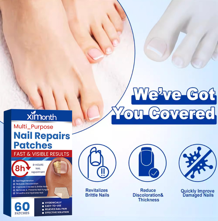Repair damaged nails Nursing tablets Nail care tablets fragile Quickly ...