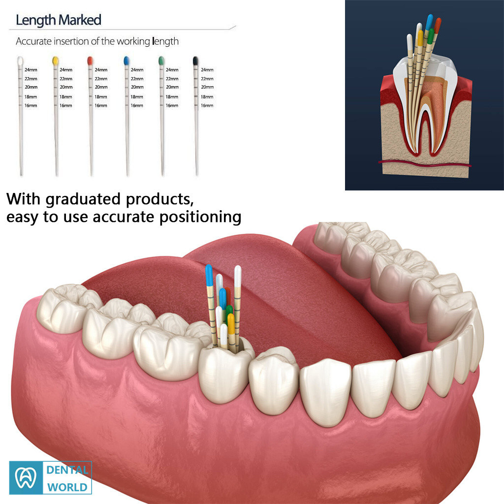 【Tape scale】1 Box Dental Absorbent Paper Points/Gutta percha points 02 ...