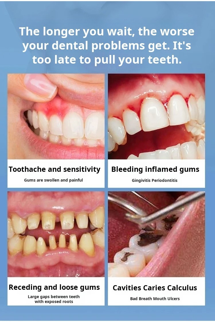 Dental Separator Toothpaste Loose Teeth Gum Shrinkage Repair Toothpaste ...