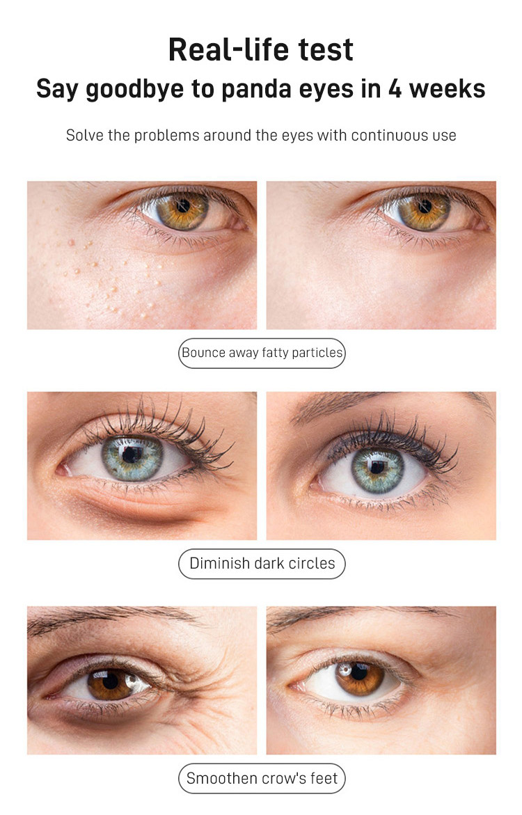 【One patch to make eye bags disappear】 Fine lines and eye bags removal ...