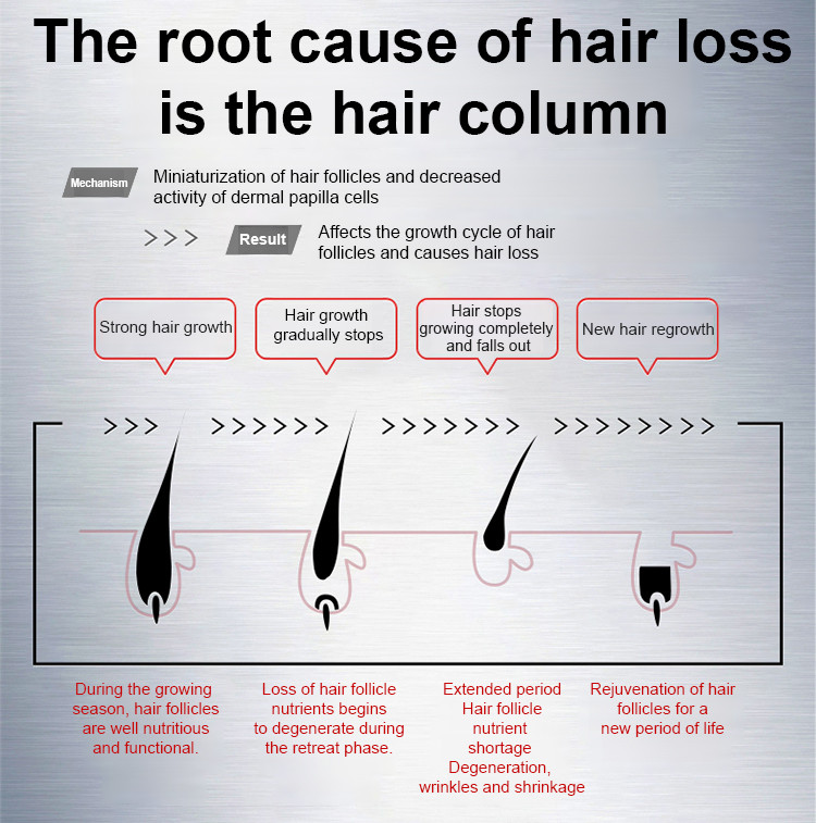 Shampoo Improve Hair Texture Dandruff Shampoo Smooth and Shiny ...