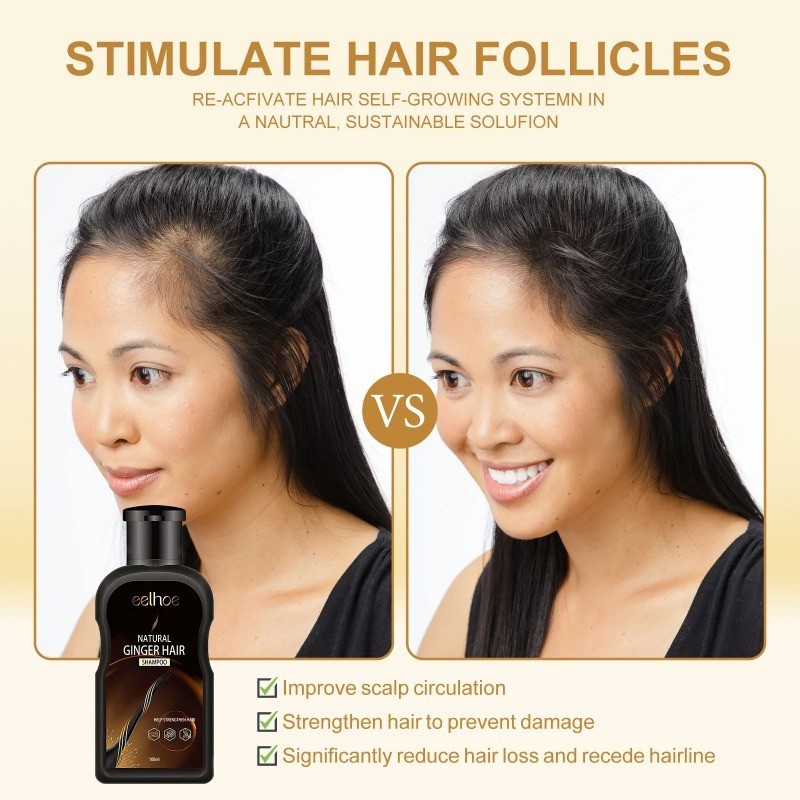 Ginger Hair Growth Shampoo Hairs Regrowth Thickening Scalp Treatment ...