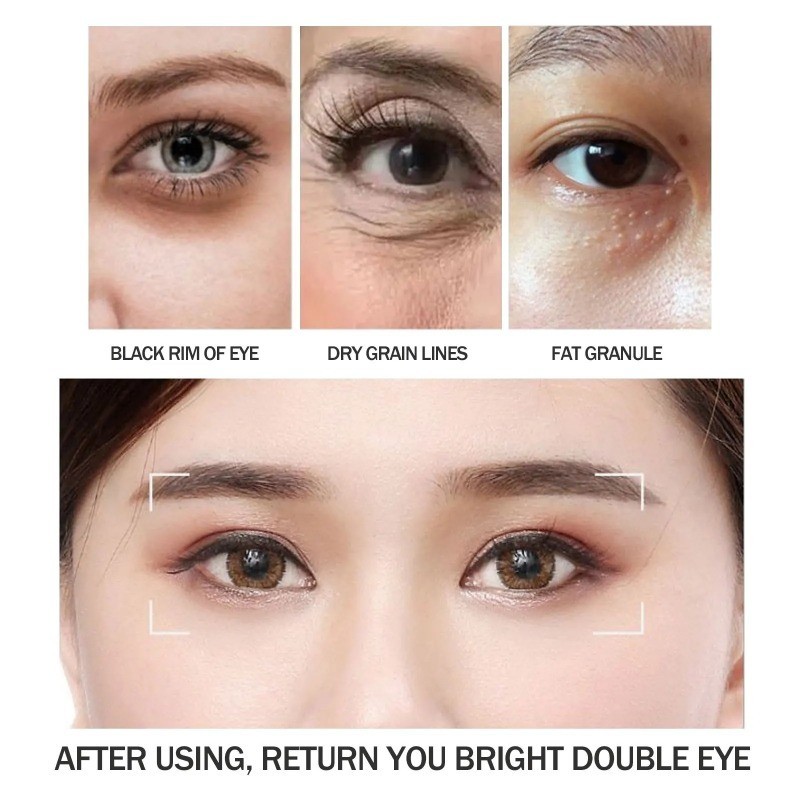 EELHOE Fat Granules Eyes Cream Eye Bag Anti-Puffiness Moisturizing ...