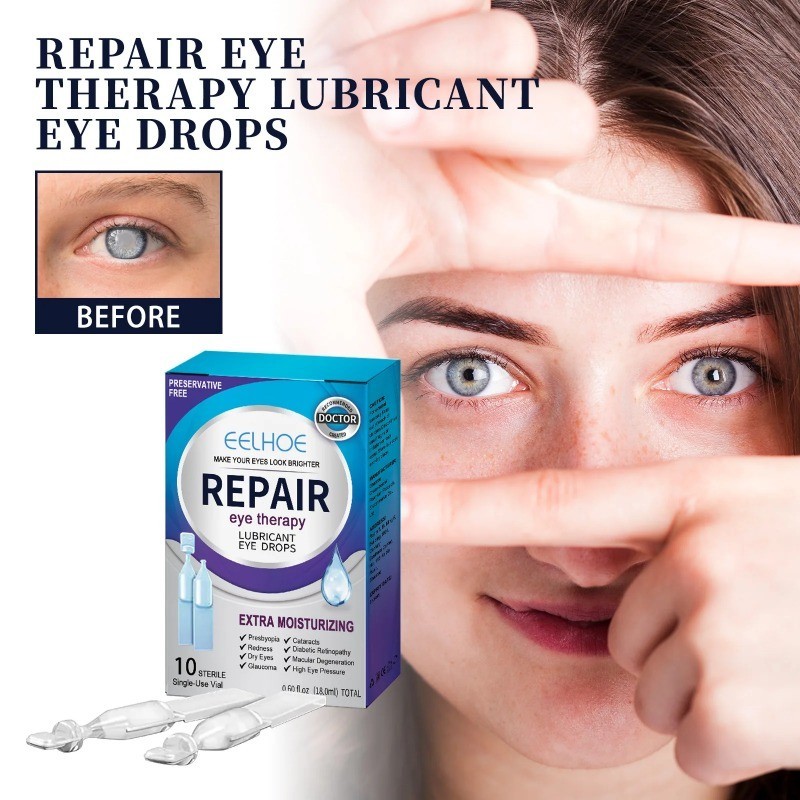 Eyesight Improvement Drop Relieve Eye Discomfort Dry Itchy Red Eyes ...