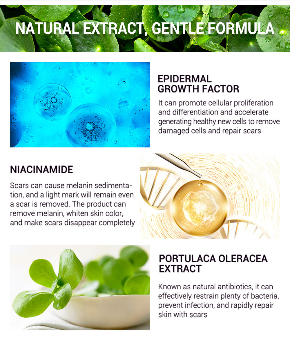 BREYLEE Acne Scar Remover Gel Lighten Stretch Marks Repairing Cream ...