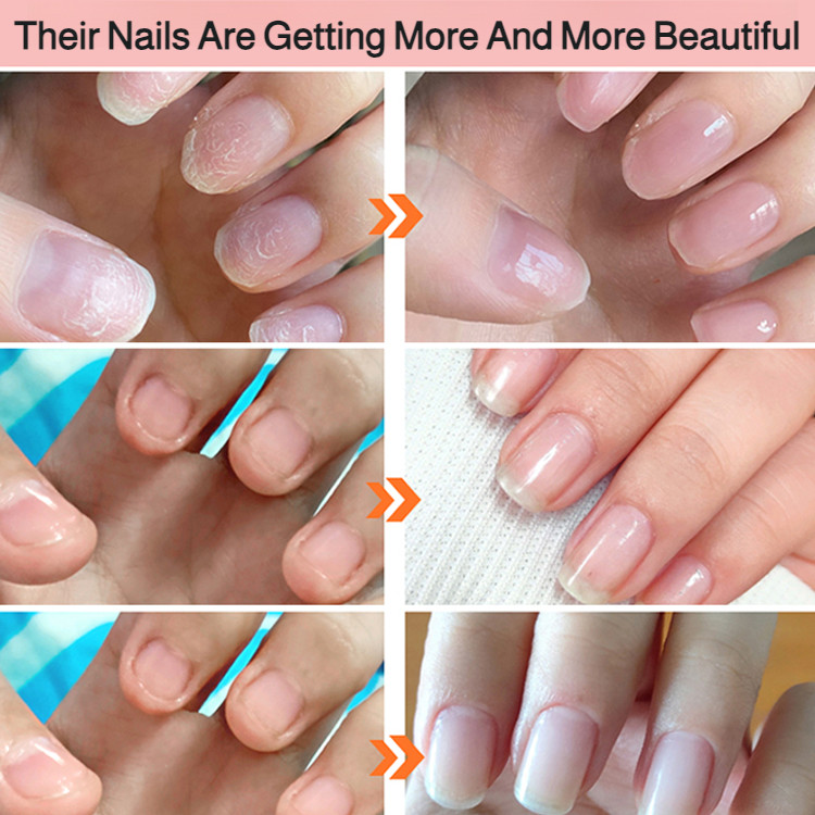 Nail Care Oil Nourishing Nail Care Nutrient Oil Pen/Nail Softener ...