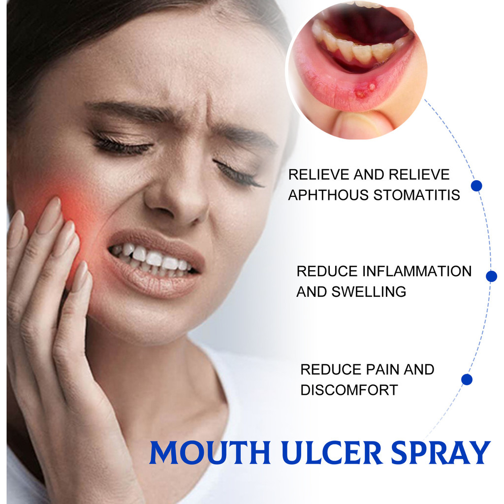 Oral Repair Spray Gum Care Spray Oral Relief Solution Gum Repair ...