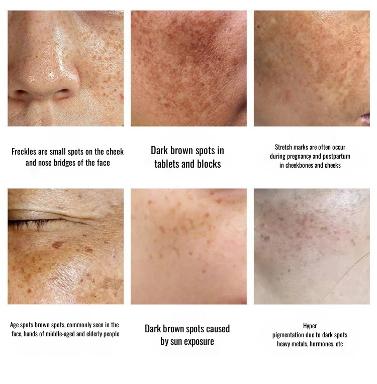 Whitening and Anti-dark Spots Mask Moisturizing Oil Control Mask Anti ...