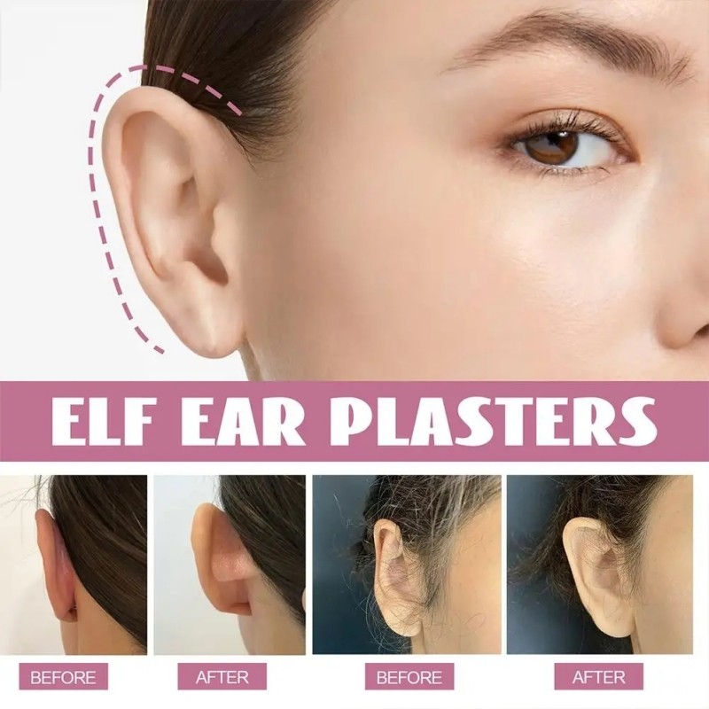 Invisible Protruding Ears Correctar Tape Ear Aesthetic Correctar Elf ...