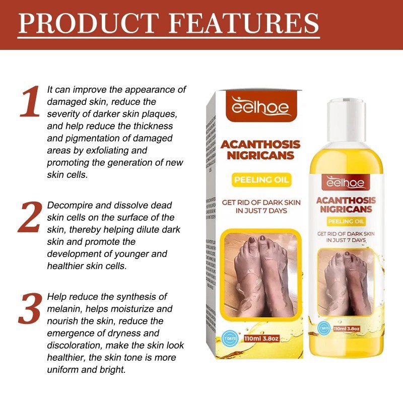 Yellow Peeling Oil Dark Skin Bleaching Lighten Knee Elbow Dark Knuckles ...