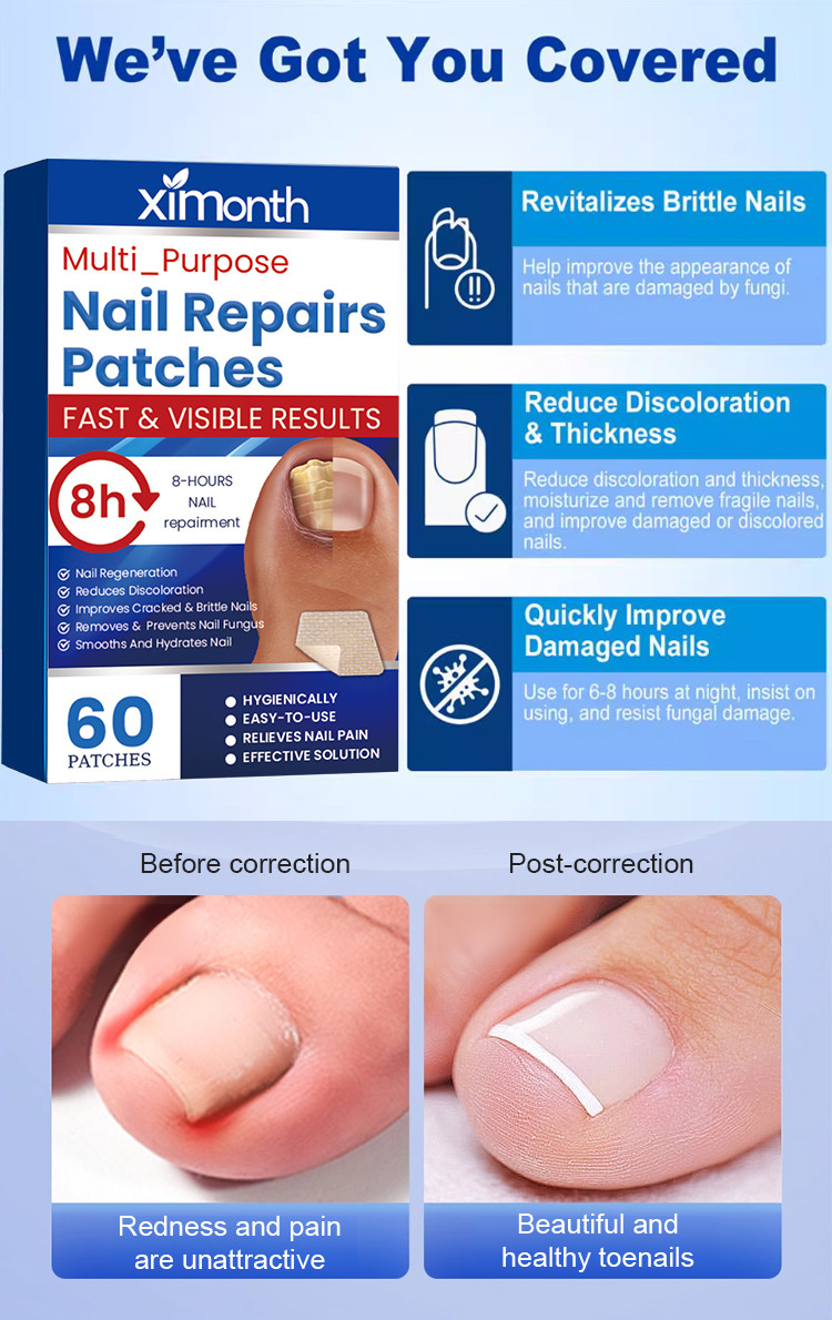 ⏰Flash Sale🥇【Nail Care】Nail Repair Stickers 🍒指甲修护贴🍒 Hand and Toenail ...