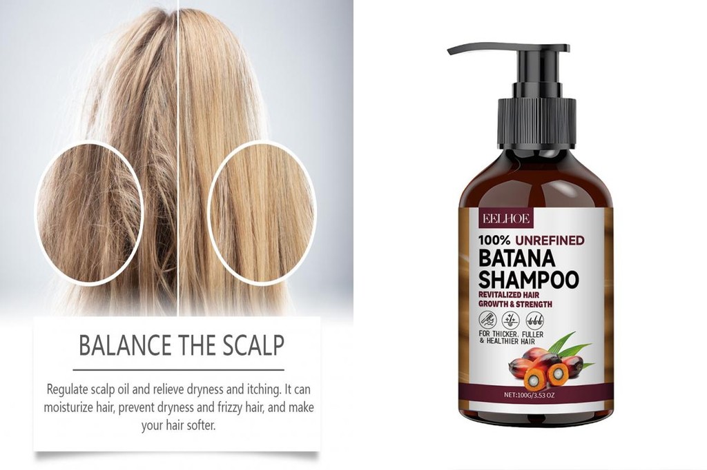 Dry Hair Shampoo Oil Control Shampoo Hydrating Batana Oil Shampoo for ...