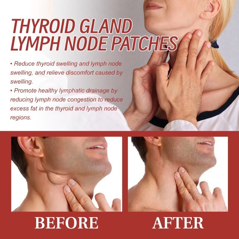 Thyroid Gland Lymph Node Plaster Throat Thyroiditis Treatment Goiter ...