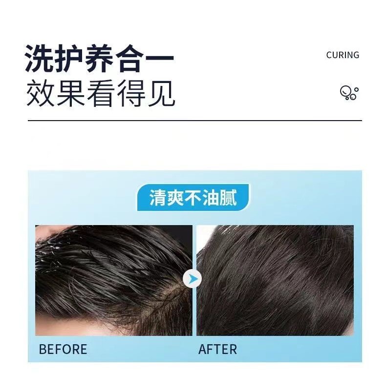 Selenium Disulfide Shampoo Mite Removal Shampoo Oil Control Shampoo Fluffy Anti-Dandruff Shampoo ...