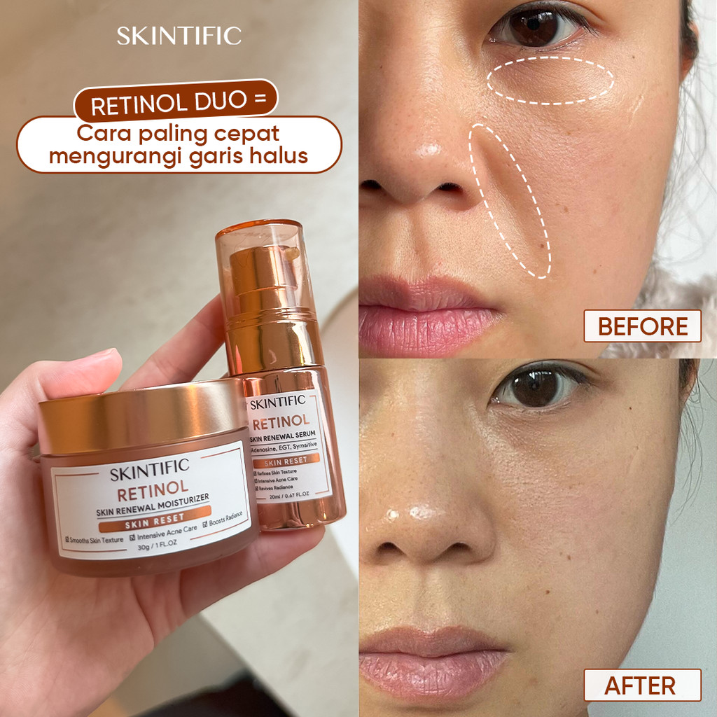 SKINTIFIC Retinol Skin Renewal Anti-Aging Retinol Anti-Wrinkle Reduce ...