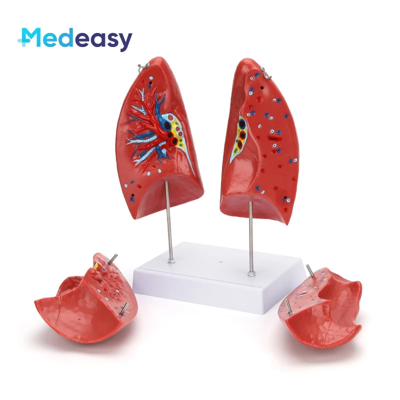 Detachable Human Anatomy Lung Anatomical Model | Shopee Malaysia