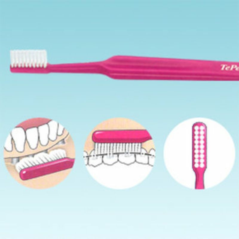 J13C Tepe Implant Orthodontic Toothbrush berus gigi braces toothbrush ...