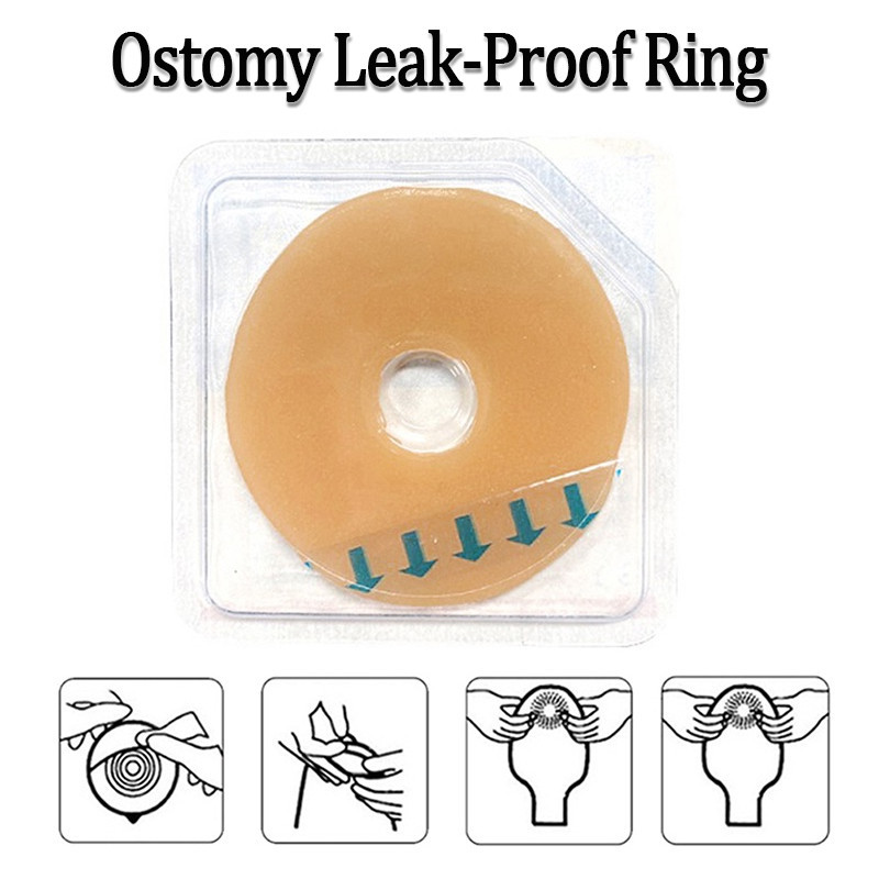 10PCS Ostomy Bag Protect Leak-proof Ring Stretch Shaping Stoma Ring ...