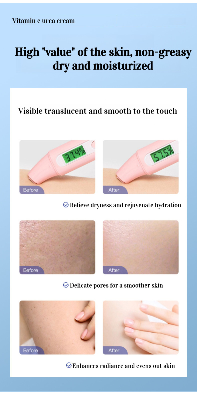 7 Days【Old Spots and Yellow Spots Disappear】Spot Fading Urea Cream Triple Whitening/Freckle ...