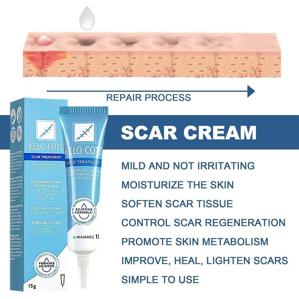 Scar Repair Cream Women's Beauty And Scar Removal Keeps The Face ...