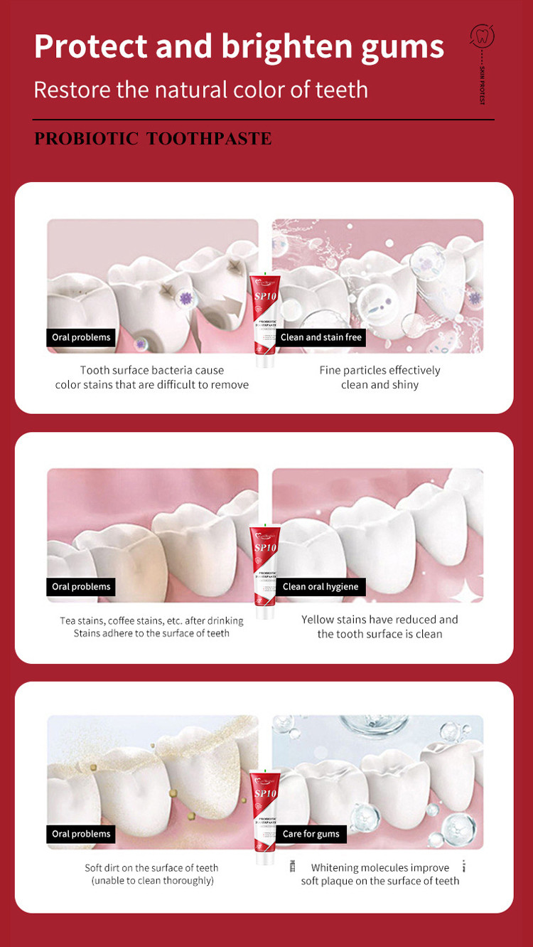 Protecting gum health Toothpaste care cream Brightening Relieve oral ...