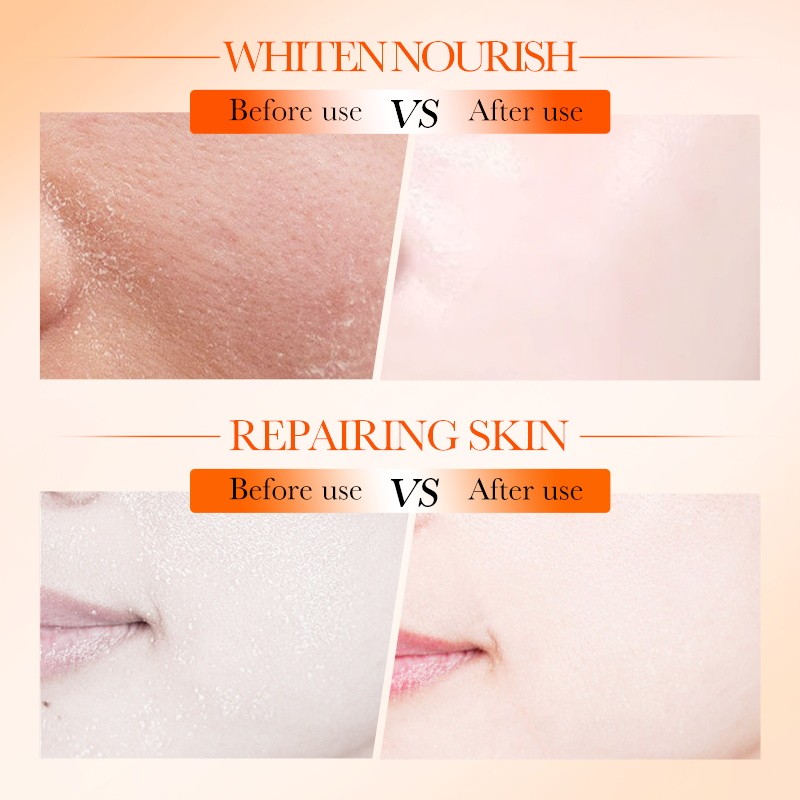 ROREC SADOER 5 Heavy Vitamin C Whitening Brightening Face Toner Niacinamide Intensive Hydrate ...