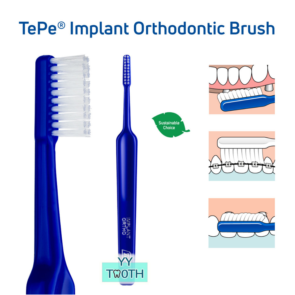 J13C Tepe Implant Orthodontic Toothbrush berus gigi braces toothbrush ...