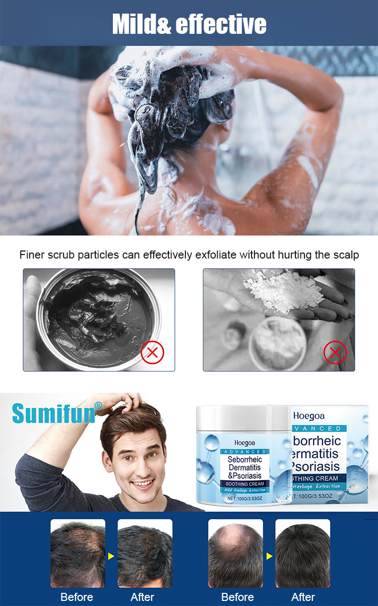 Improve scalp environment scalp care products Scalp Soothing Cream ...