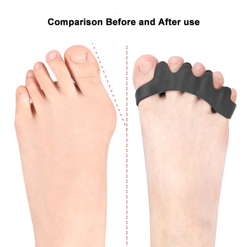 One Pair Toe Separator Silicone Separation Five Holes Separation Clip ...
