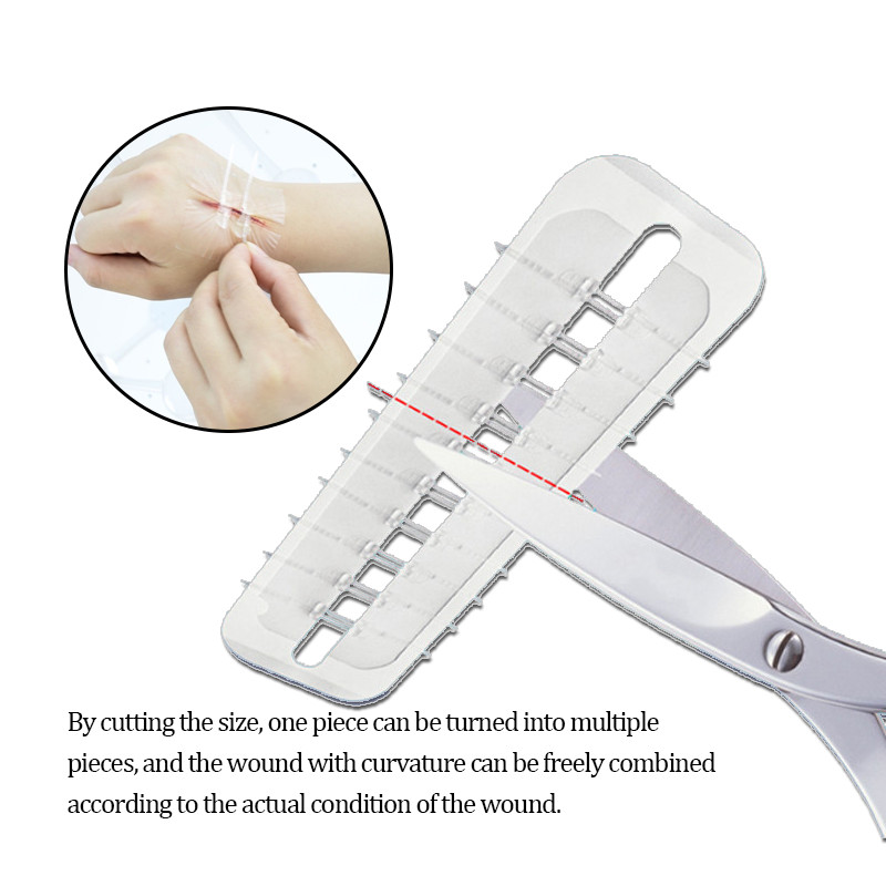 2/10-Button Medical Wound Closure Patch Wound Quick Suture Zipper Band ...