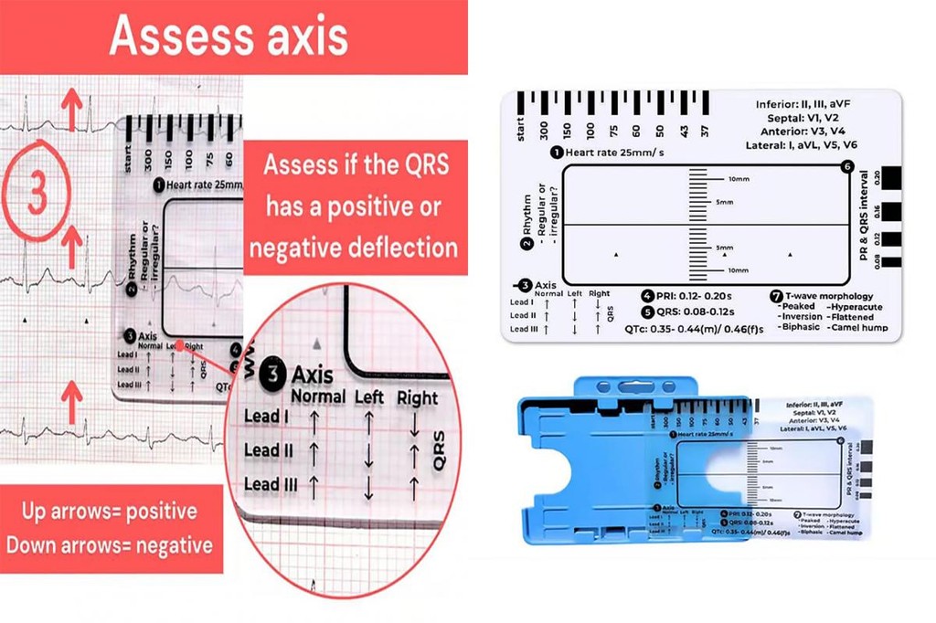 [richu] Assessment Tool Heart Rate Assessment Tool Portable Ecg ...