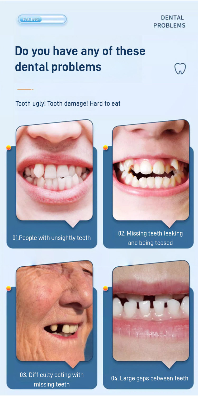 🔥Limited discount🔥【100% Original】Adjustable buckle dentures ...