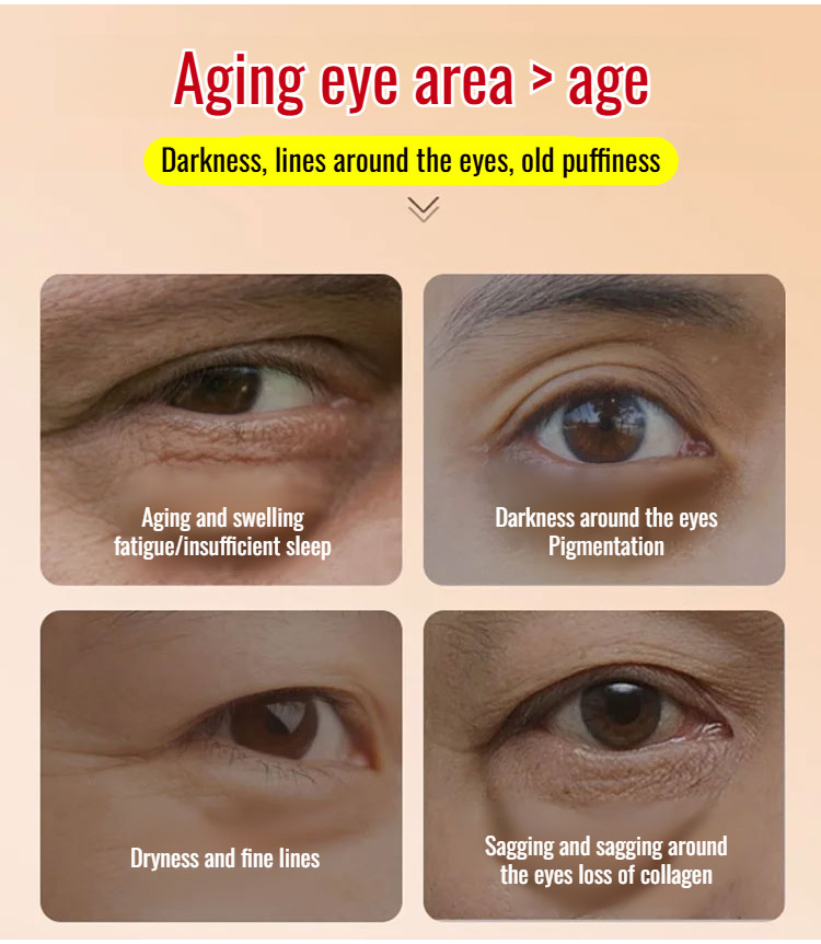 Eye Serum Oil Eye Treatment Essence Eye Serum Tenderness Reduce Dryness ...