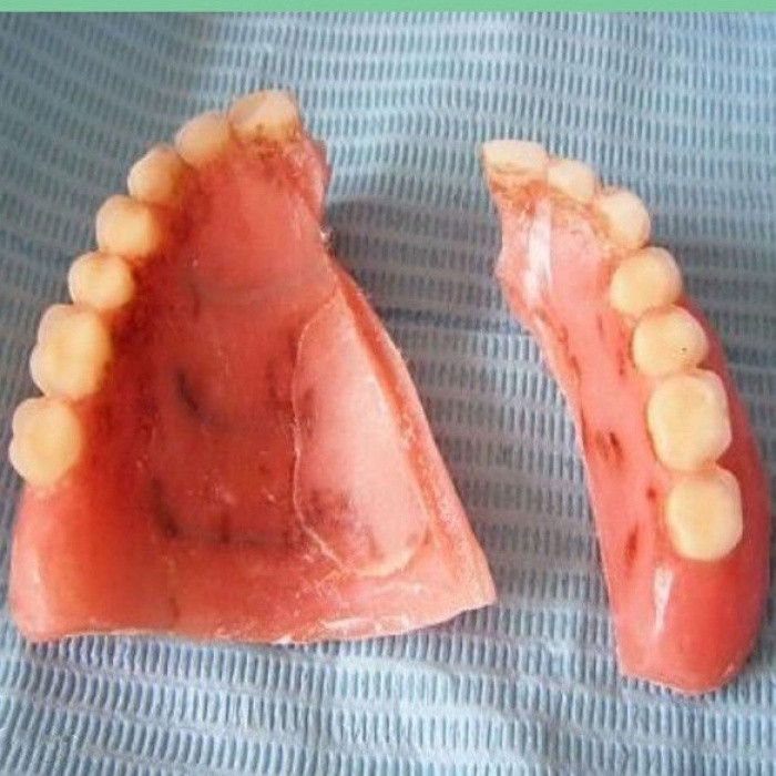 Movable Denture Glue Dentures Falling Off Sticky Teeth Broken Dentures ...