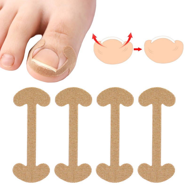 5 Sheets Paronychia Stickers - Nail Correction Patch - Ingrown Toenail ...