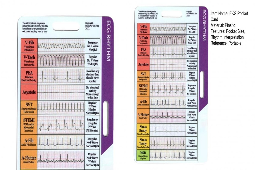 Lightweight Ekg Rhythms Card Ekg Rhythm Pocket Card Pocket Ekg Rhythm Interpretation Card for ...