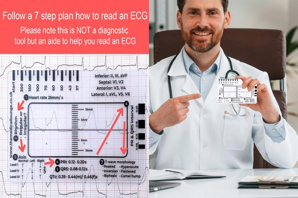 MO Ekg Reference Card Ekg Interpretation Tool Transparent Ekg Caliper ...