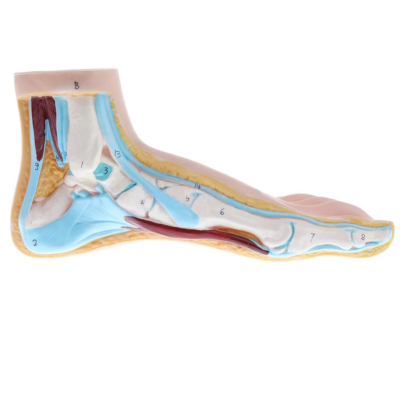 Normal foot Arch foot High arch foot model Foot joint model Claw foot ...