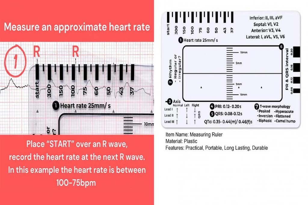 [TS] Heart Rate Assessment Tool Axis Deviation Reference Guide Portable Ecg Interpretation Guide ...