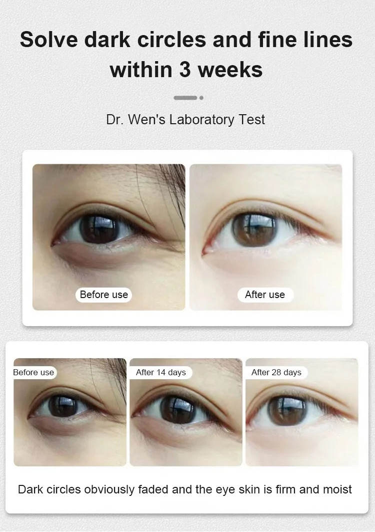 Dinkiss Lutein Eye Serum Brightens and smooths reduces wrinkles and eye ...