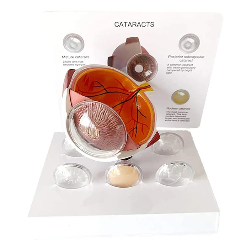 Cornea Eyeball Model Human Eye Model Human Eye Demonstration Teaching ...