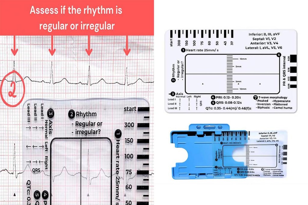 Ou Heart Rate Assessment Tool Assessment Tool Portable Ecg ...
