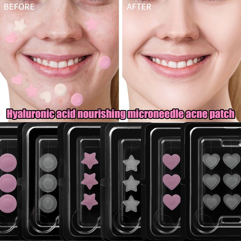 Soluble Painless Microneedle Acne Patch - Invisible Transparent Acne ...
