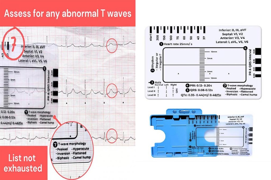 angeyong 7 Step Ruler Portable 7-step Ruler Measuring Tool for Ecg ...