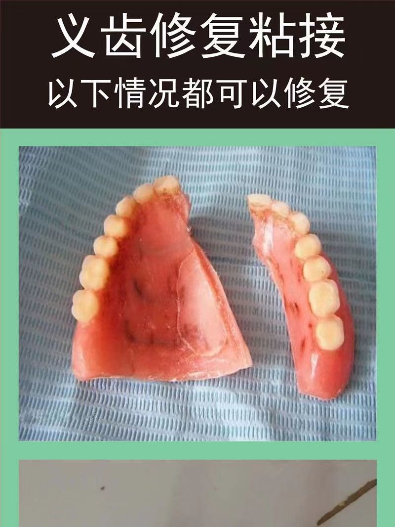 Movable Denture Glue Dentures Falling Off Sticky Teeth Broken Dentures ...