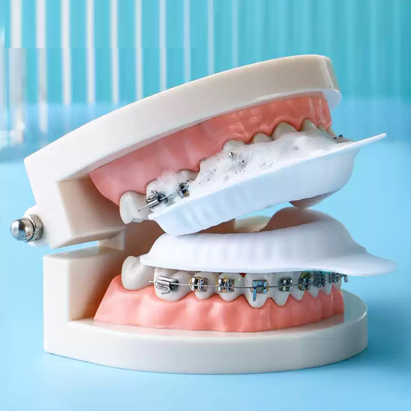 Dental Fluoride Tray Disposable Fluorinated Foam S M L Baby Denture ...